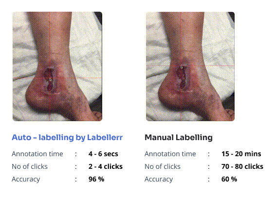 Enhancing Wound Image Segmentation with Labellerr